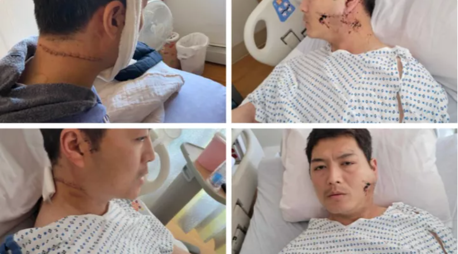 Flushing organization launches GoFundMe campaign to support Asian man ...