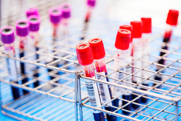 New York Blood Center declares blood emergency following deep drop in ...